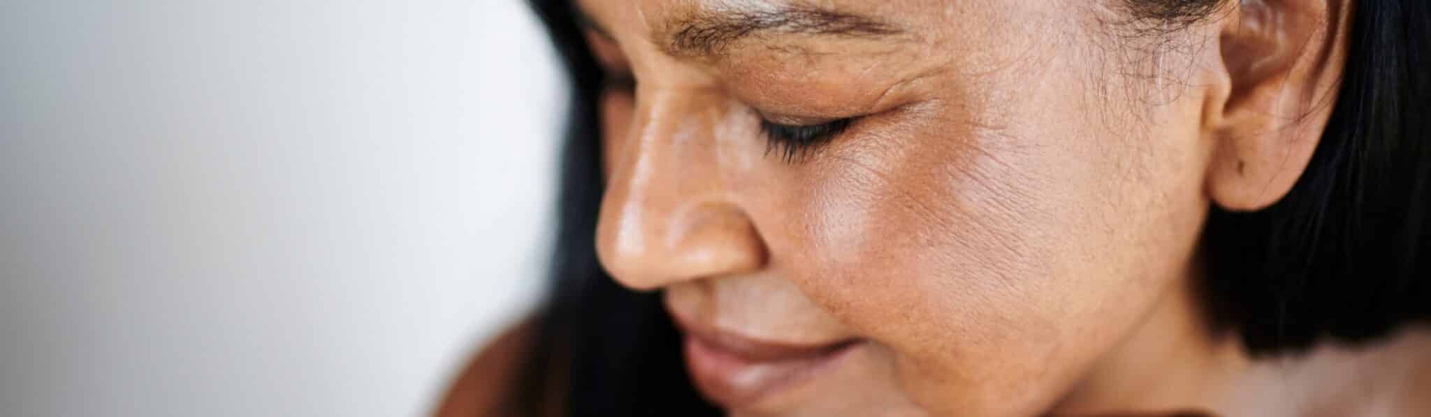 Qu’est-ce que le botox et pour quelles rides est-il recommandé ? | Dr ...